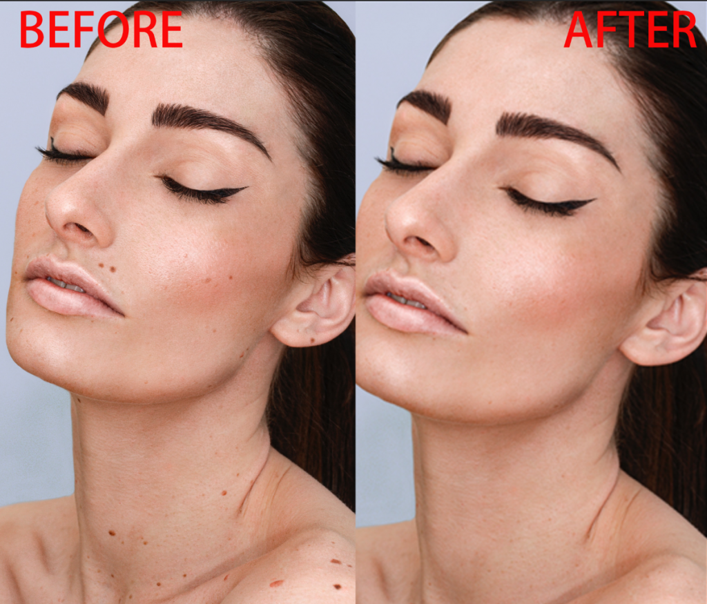 How to Remove Blemish from Photos?